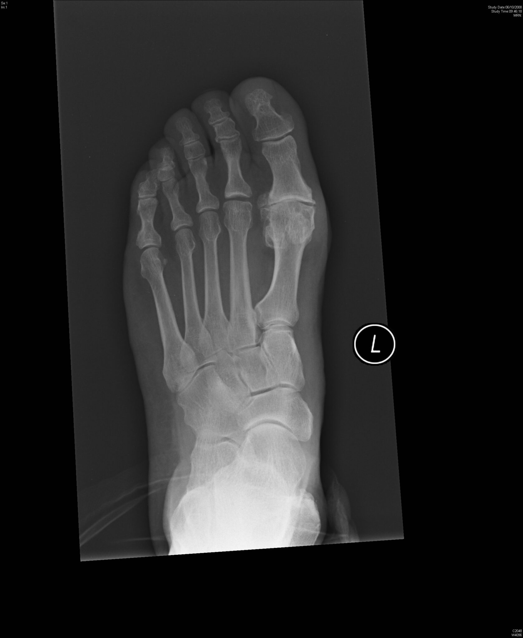 Forefoot Surgery Course – www.orthocycle.org